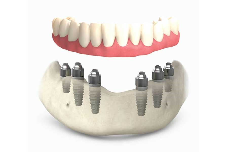 Saigon Dental Hospital - Partner of Malo Dental International
